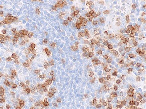 We Are Thrilled To Start Off The New Year With The Introduction Of Our