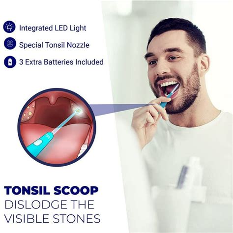 Tonsil Stone Removal