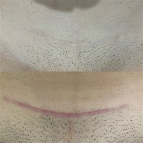 Yung Bod How A C Section Mamas New Creation Is Helping Other C