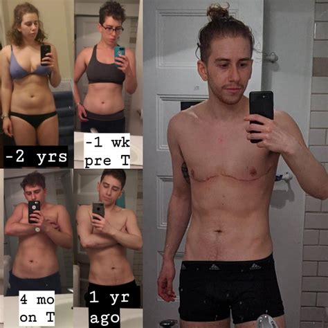 Transicao Ftm Antes E Depois Das Fotos Elon Musks Daughter Reveals