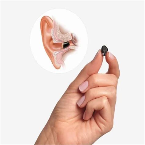 Analog Phonak Iic Hearing Aids Behind The Ear At ₹ 7000unit In