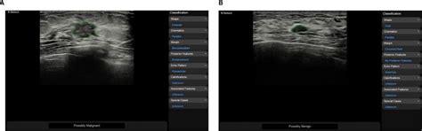 Aiinhealthcare Mammography Ultrasound Radiology