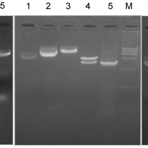 Restriction Pattern Profiles Of Digested Plasmids Plasmid Pa Gel On