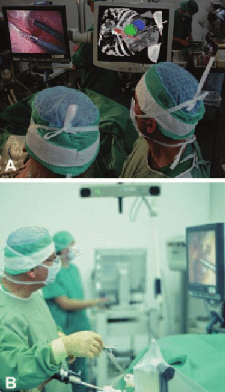 The Photos Show The Navigation System In Use During Laparoscopic