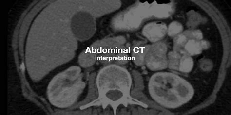 Abdominal Ct Oesophagus And Stomach • Litfl • Radiology