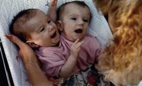Abby And Brittany Hensel Conjoined Twins Sex Life Bxegorilla