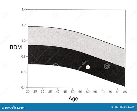 Dexa Bone Mineral Density Graph Osteopenia Present Royalty Free