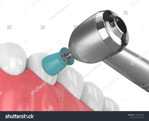 Prophy Cup Over 11 Royalty Free Licensable Stock Illustrations And Drawings Shutterstock
