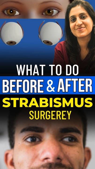 What To Do Before And After Strabismus Surgery Youtube