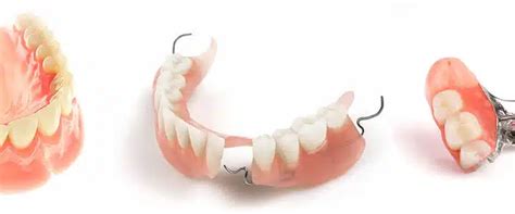 Proteza Dentara Elastica Totala Archives Dental Premier Clinica