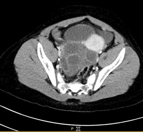 Ct With Contrast Ap View Download Scientific Diagram