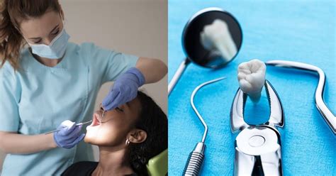 7 Most Important Things To Know About Pulling Teeth For Braces