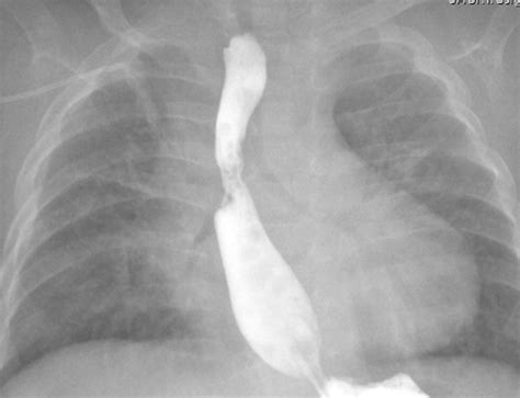 Postoperative Contrast Study Download Scientific Diagram