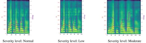 Figure 3 From Accurate Synthesis Of Dysarthric Speech For Asr Data