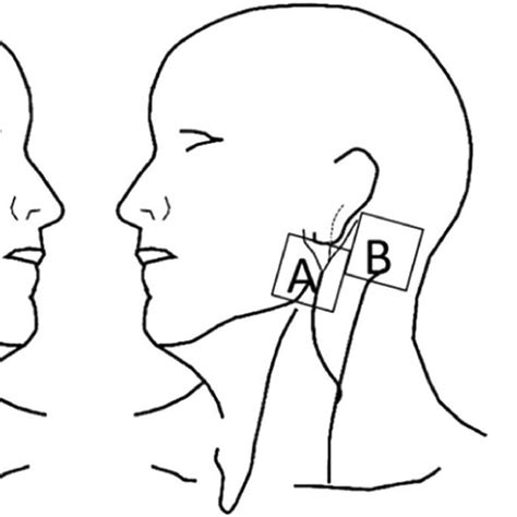 Test Sites For Qst Bilateral Subauricular Sites A Bilateral