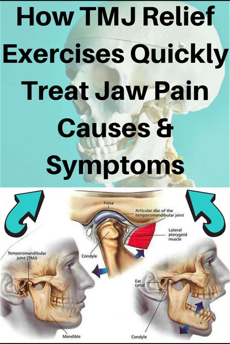 Tmj Pain Relief Exercise At Brayden Woodd Blog