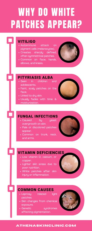 Understanding White Patches On The Skin Causes And Care Skin