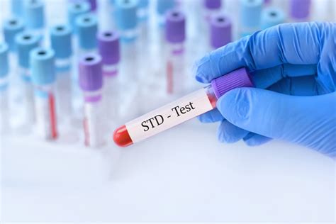 Why Std Testing Matters Laguna Urgent Care