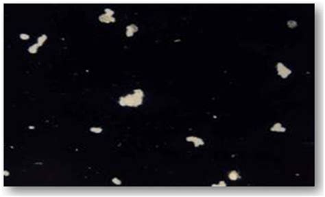 Positive Microscopic Agglutination Test Mat At A Titre Of 1640