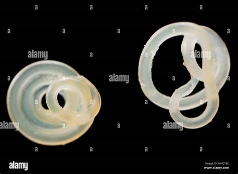 Nematoda Roundworms