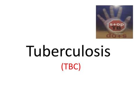Ppt Materi Tuberculosis Paru Fixed Pptx Pptx