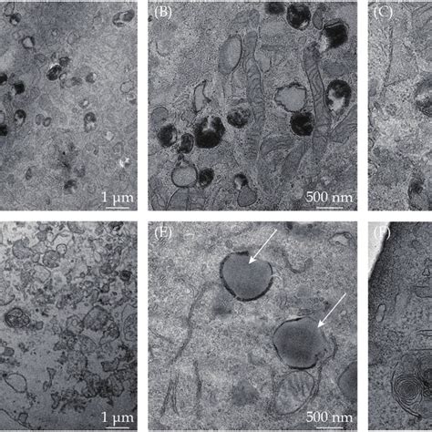 Electron Microscope Images Showing Impaired Autophagy In Ttntv P