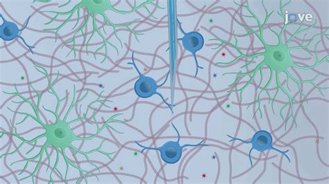 Video Stereotaktyczne Wstrzykiwanie Wektorów Wirusowych Do