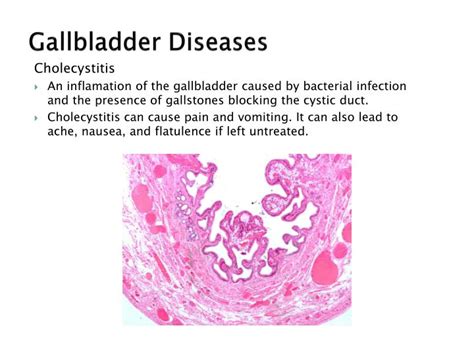 Ppt Structure And Function The Gallbladder Powerpoint Presentation Id 2084742
