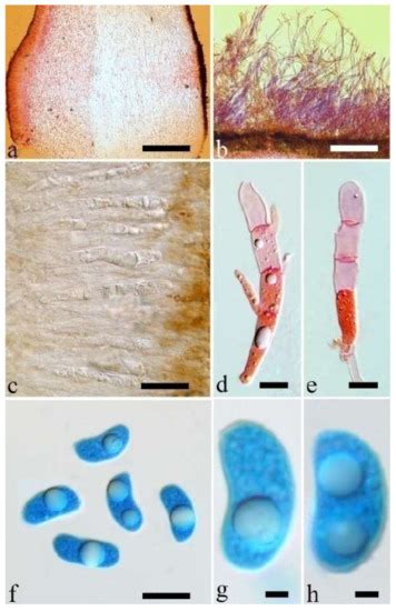 Global Diversity And Updated Phylogeny Of Auricularia Auriculariales