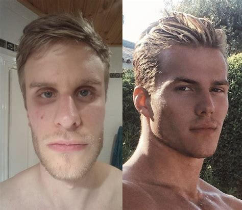 Rate My Before And After Looksmaxxing And Gym Routine No Surgery