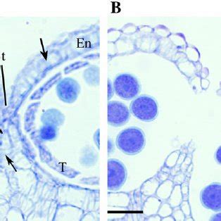 Pdf The Final Split The Regulation Of Anther Dehiscence
