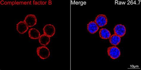 Invitrogen Complement Factor B Recombinant Rabbit Monoclonal Antibody