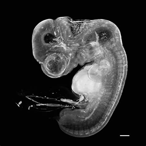 Ultrasound Imaging Of Early Embryonic And Fetal Development Article