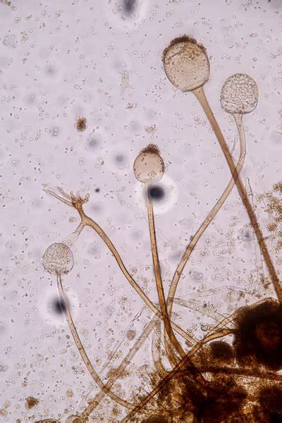 Rhizopus Under Microscope Labeled Rhizopus Under Microscope Labeled