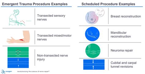 Axogen Repairing Lives Of Patients With Peripheral Nerve Injuries
