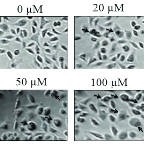 Dapi Staining Assay Presenting Apoptotic Cell Morphology And Damage