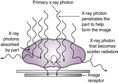 Image Formation And Radiographic Quality Radiology Key