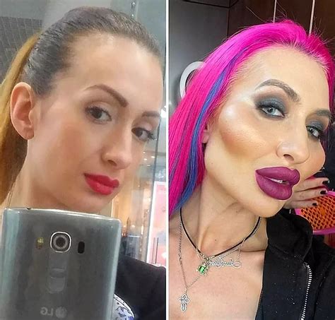 Dünyanın En Büyük Elmacık Kemiğine Sahip Anastasia Pokreshchuk Bu