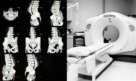 Ct Scan For Abdomen And Pelvis Kiran Lab