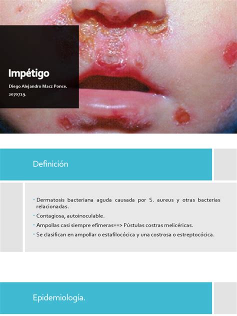 Impétigo Vulgar Pdf Inmunología Medicina