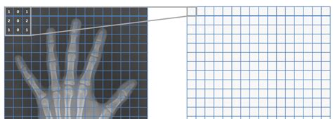 Bone Age Prediction Through X Ray Images By Insidetechlabs Techlabs Medium