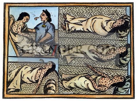 Smallpox Aztec