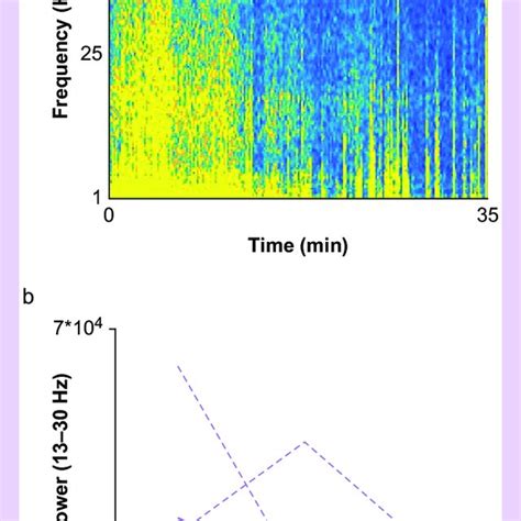 A Spectrogram Of The Neuronal Activity Before During And After