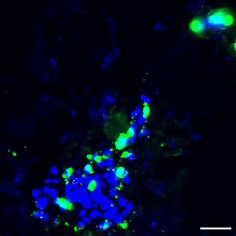 Mast Cell Tryptase Antibody Anti Human Readyelease™ Miltenyi