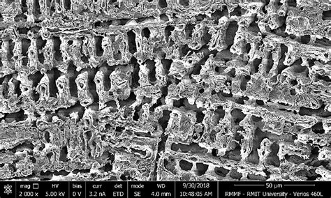 New Copper Surface Eliminates Bacteria In Just Two Minutes Rmit