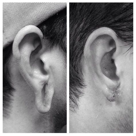 Gauging Ears Timeline At Joshua Tyler Blog