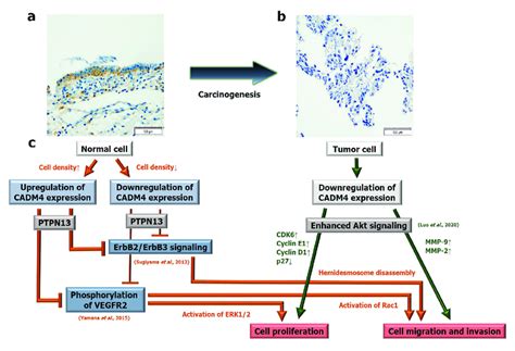 A Normal Cells Of The Gallbladder Mucosa Showed Relatively Uniform Download Scientific