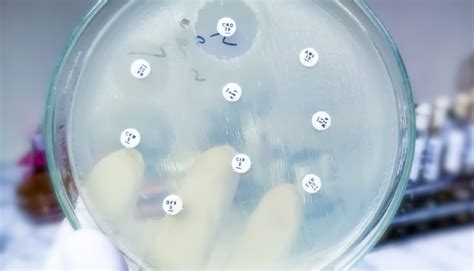 Uk £39 Million Funding To Fight Global Antimicrobial Resistance Transcrip