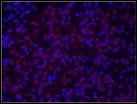 Cell Detection In Qupath Not Working Across Samples Image Analysis
