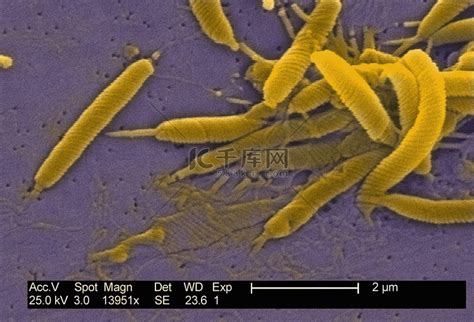 菜青链霉菌的扫描电子显微镜高清摄影大图 千库网